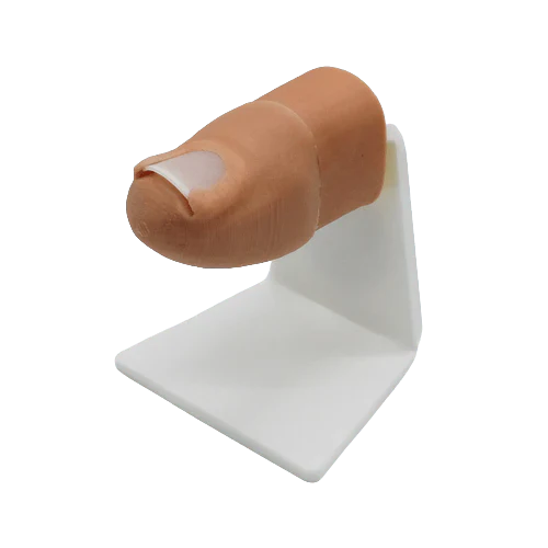 Ingrown Toenail Surgical Simulator (Onychocryptosis) — Pristine Medical